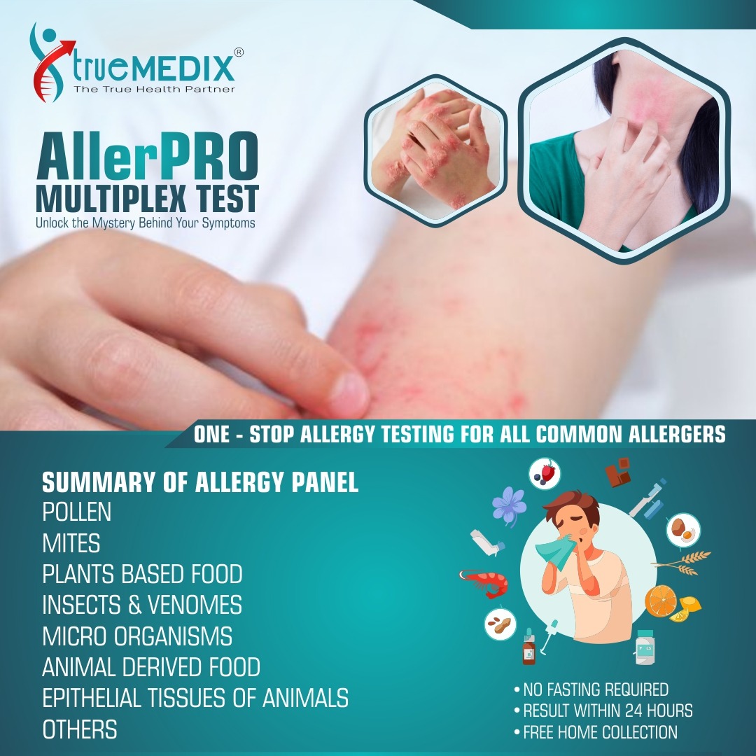 Unraveling Allergies: How the Allerpro Multiplex Test Works